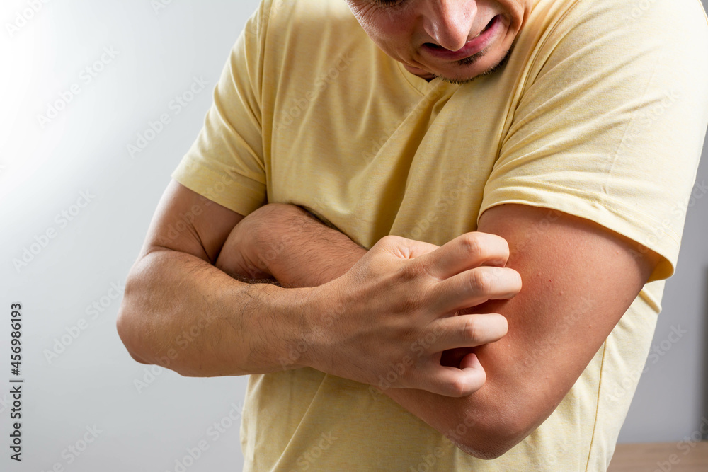 Annoyed middle-aged man in yellow t-shirt scratching itch on his arm ...
