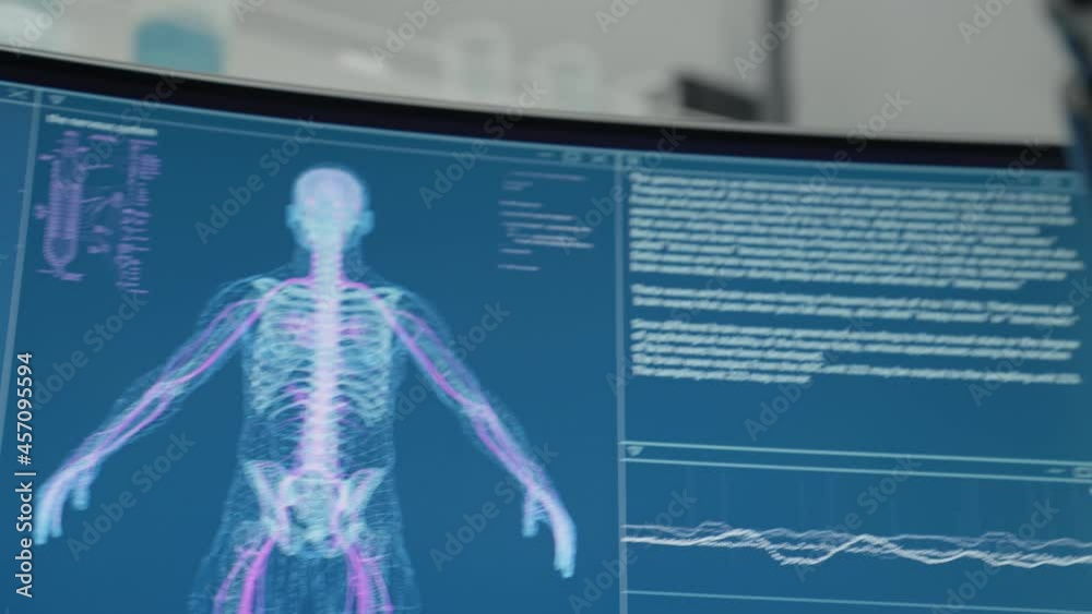 Human skeleton models on computer screen. Looking for injury ...