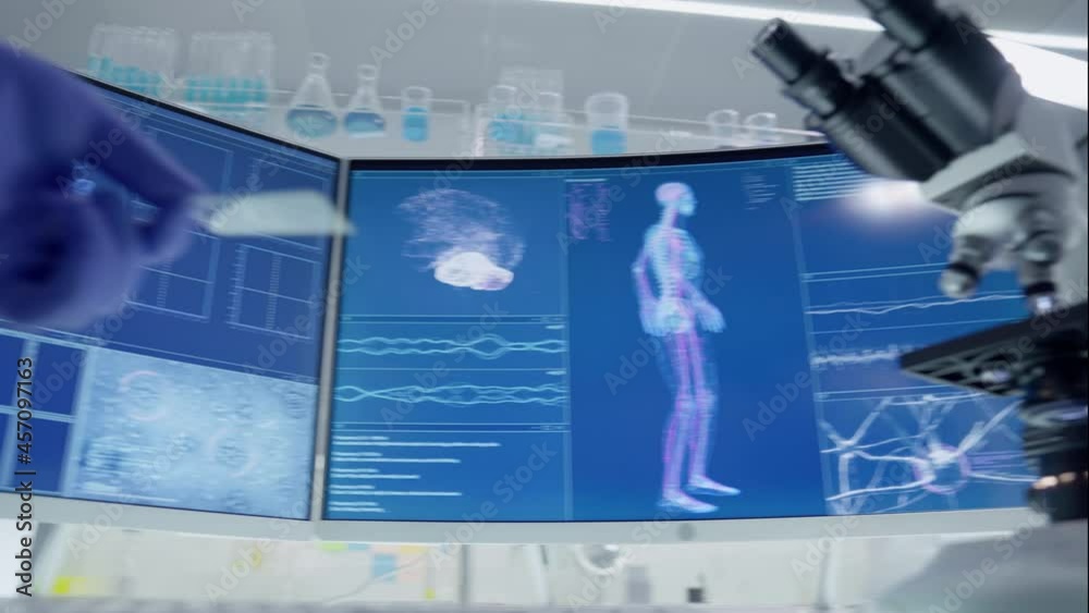 Human skeleton models on computer screen. Looking for injury ...