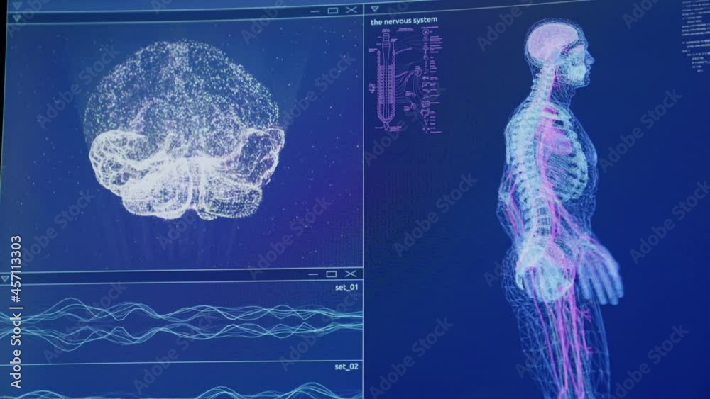 Human skeleton models on computer screen. Looking for injury ...