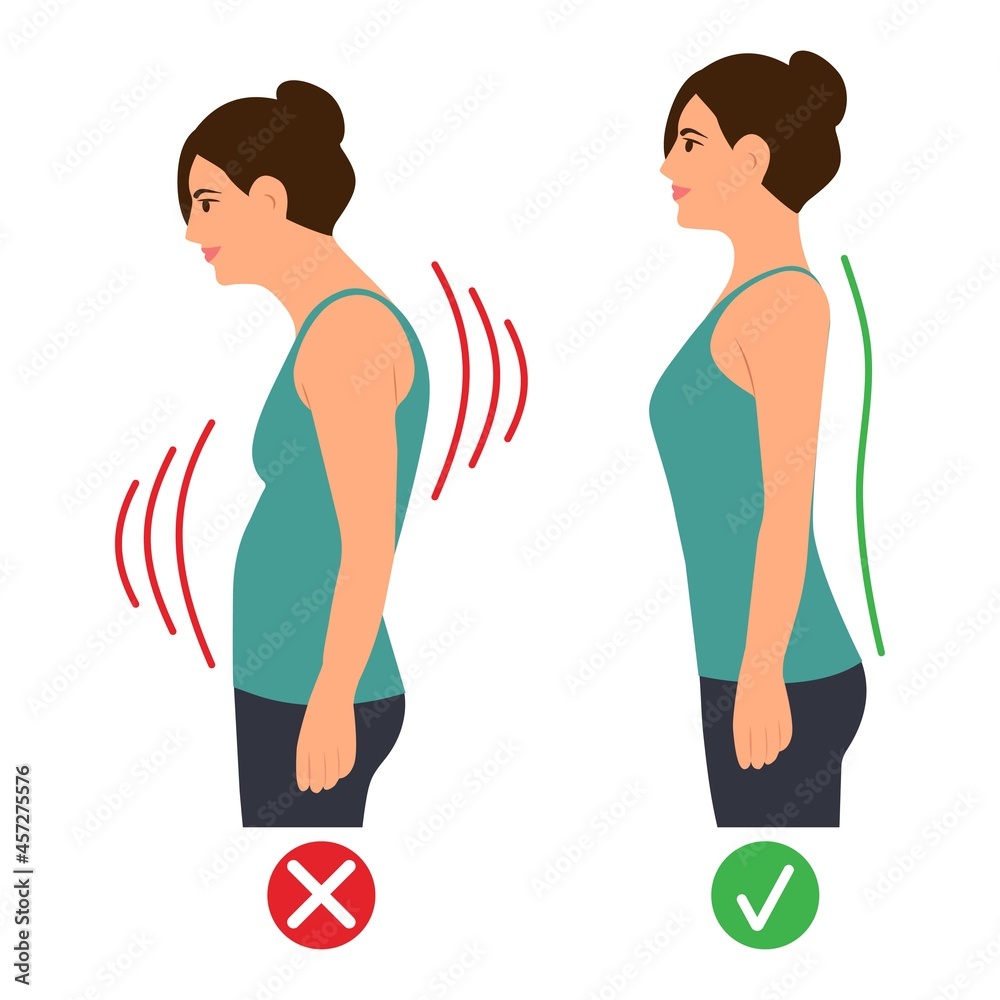 Correct and incorrect standing posture.Cervical spinal curvature. Hump ...