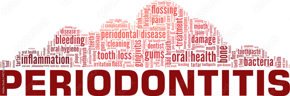 Periodontitis - Periodontal Disease vector illustration word cloud ...