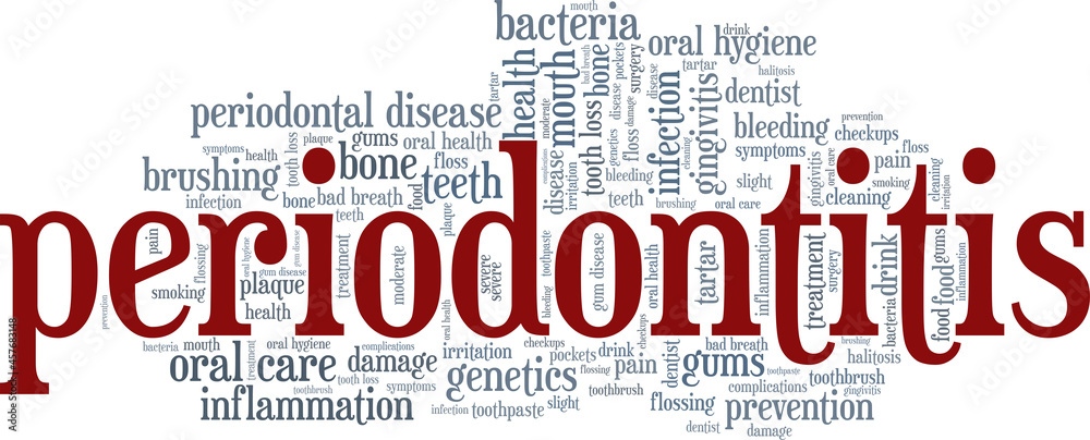 Periodontitis - Periodontal Disease vector illustration word cloud ...