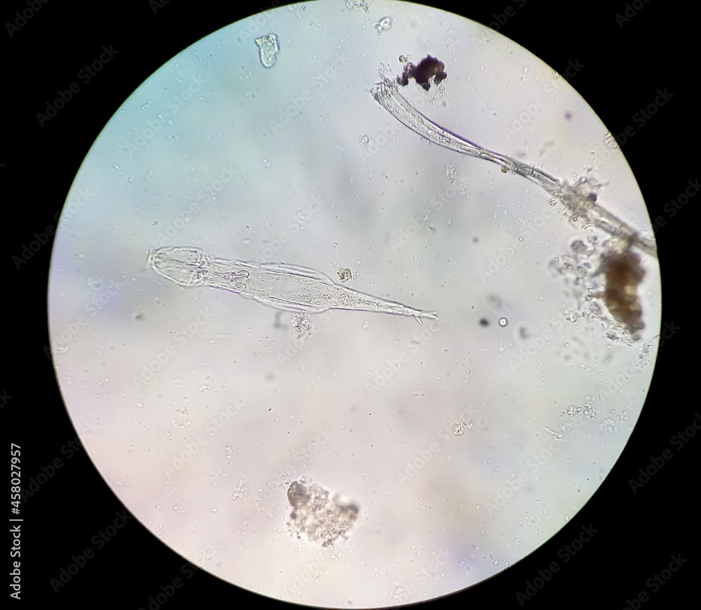 Schistosoma