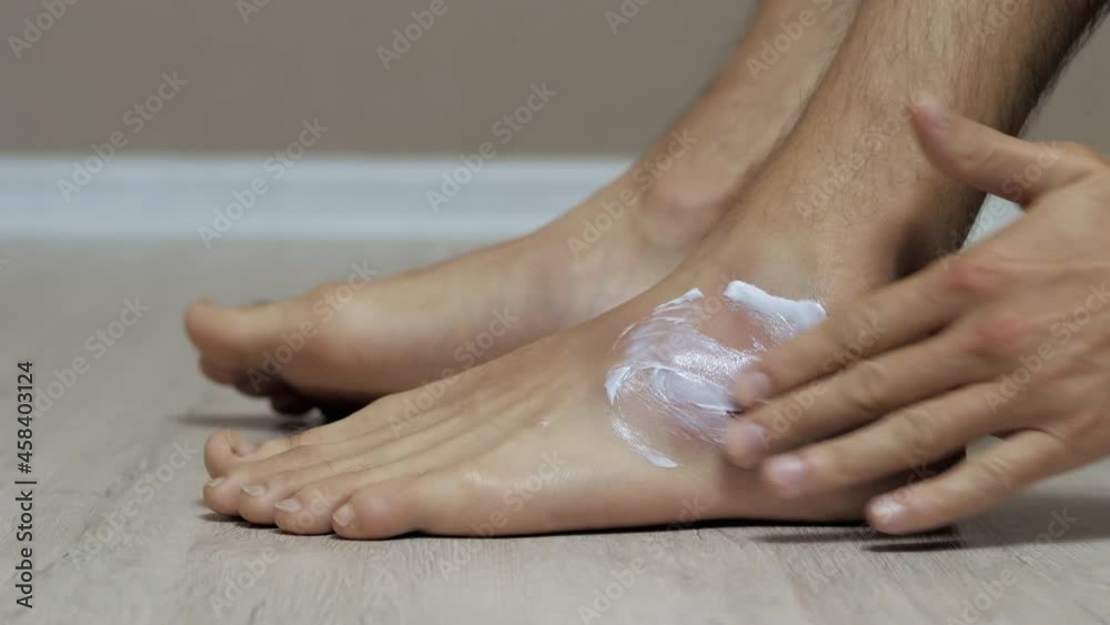Close-up of a man's hand smearing healing cream a bruise on the foot, a ...
