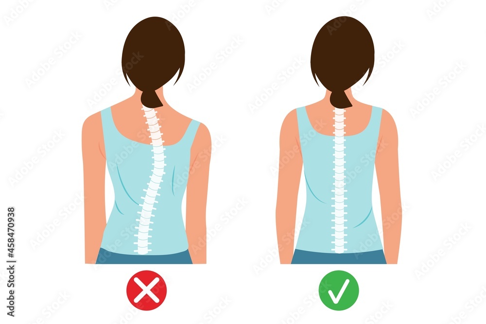 Woman's body and backbone.Infographic illustration of back view woman ...