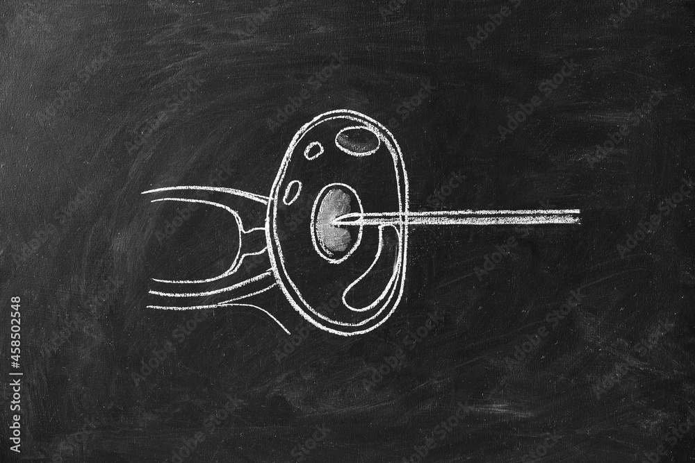 Artificial insemination. Graphic medical illustration. In vitro ...