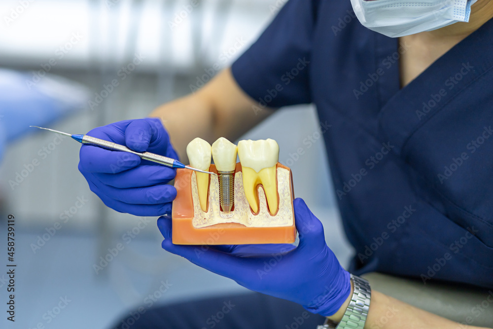 training, education, practicing dentist work. demonstration model of ...