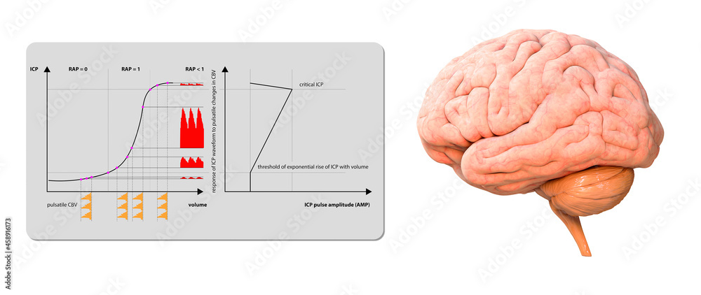 Intracranial Pressure Monitoring Icp Waveform 3d Render 2d Graphic Stock Illustration Adobe