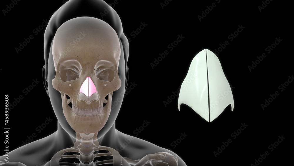 The lateral cartilage (upper lateral cartilage, lateral process of ...