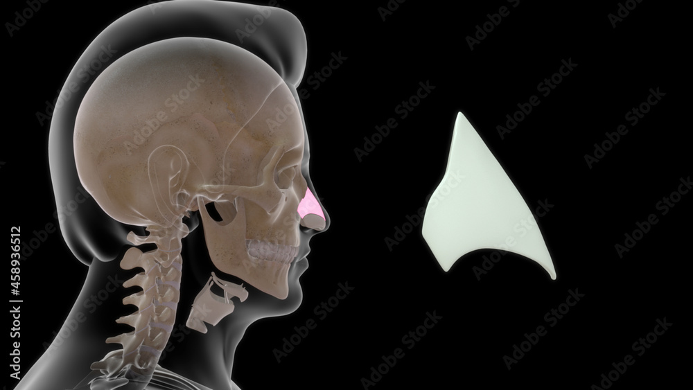 The lateral cartilage (upper lateral cartilage, lateral process of ...