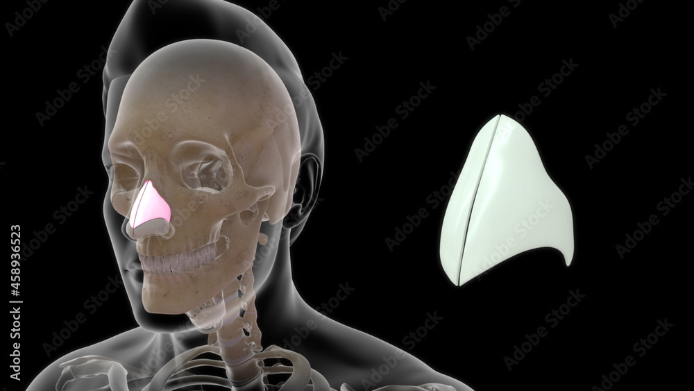 The lateral cartilage (upper lateral cartilage, lateral process of ...