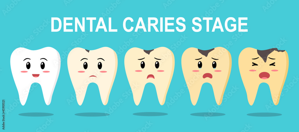 Dental caries stage cartoon character concept vector illustration ...