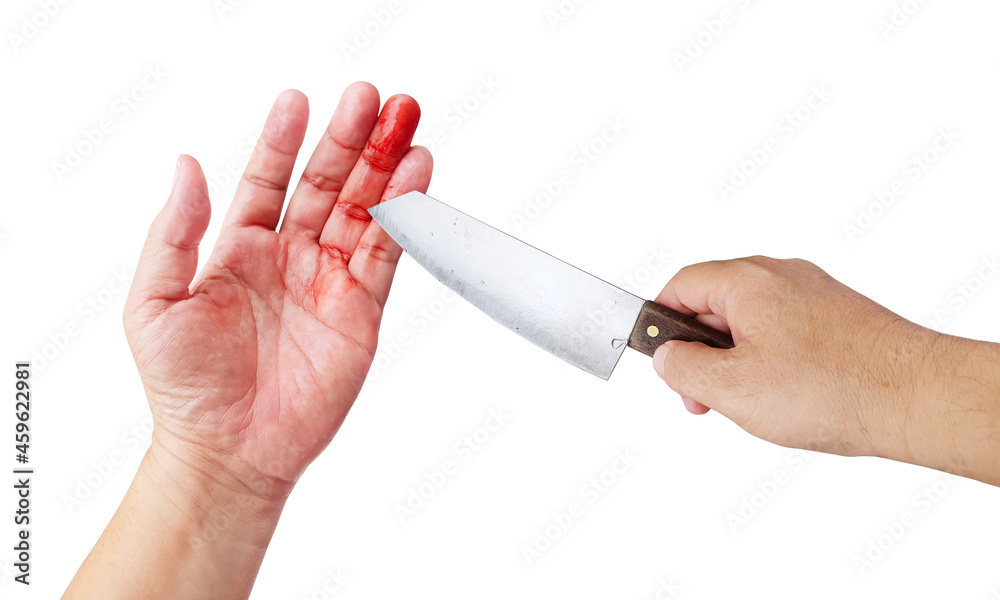 The knife cuts the hand, the wound is bleeding. unexpected accident different from the white ...