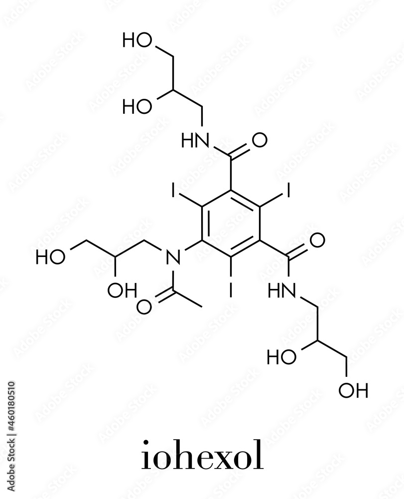 Iohexol contrast agent molecule. Used in coronary angiography ...