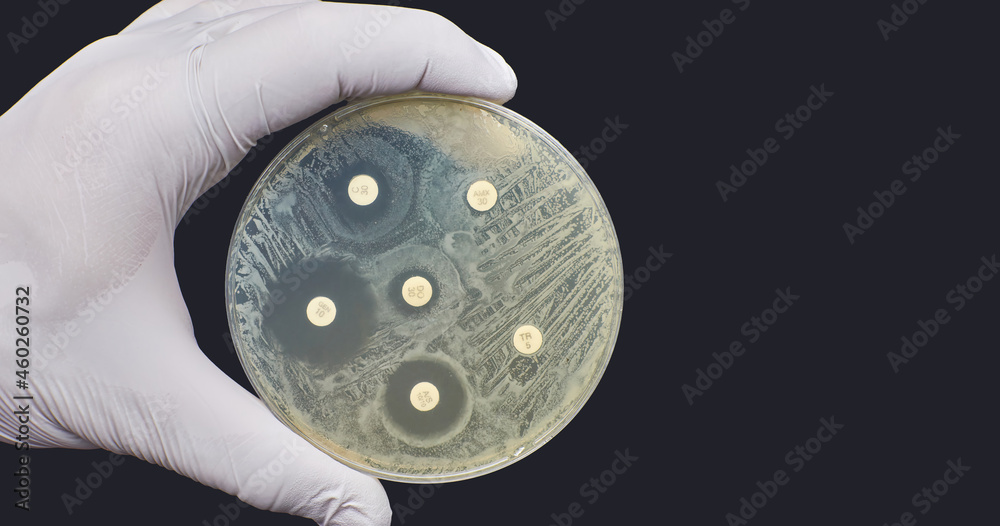 Antibiogram Kirby Bauer Antimicrobial susceptibility resistance ... Antibiogram Kirby Bauer Antimicrobial susceptibility resistance ...