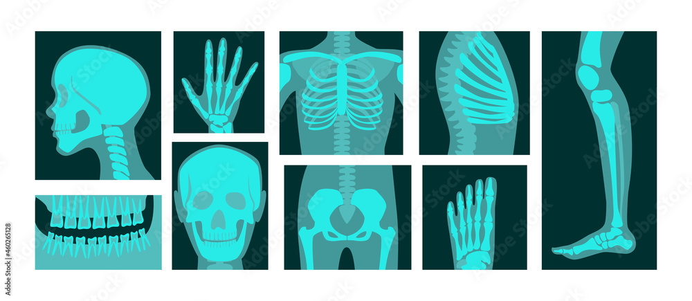 X-ray of human body parts vector illustrations set. Bones of skeleton ...