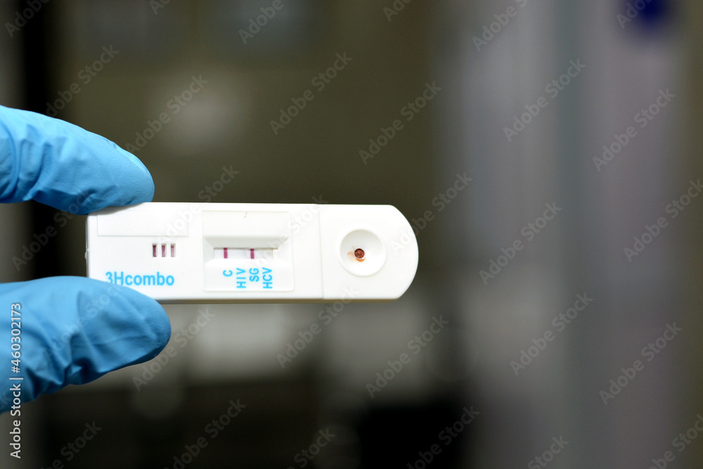 Positive result of Hepatitis B surface antigen and negative HCV and HIV ...