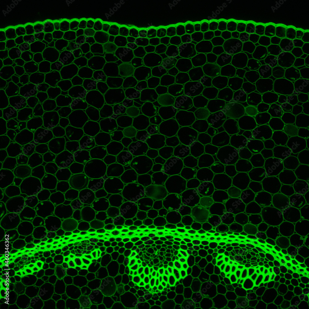 Convallaria plant microscopic sample, fluorescence signal observed with ...