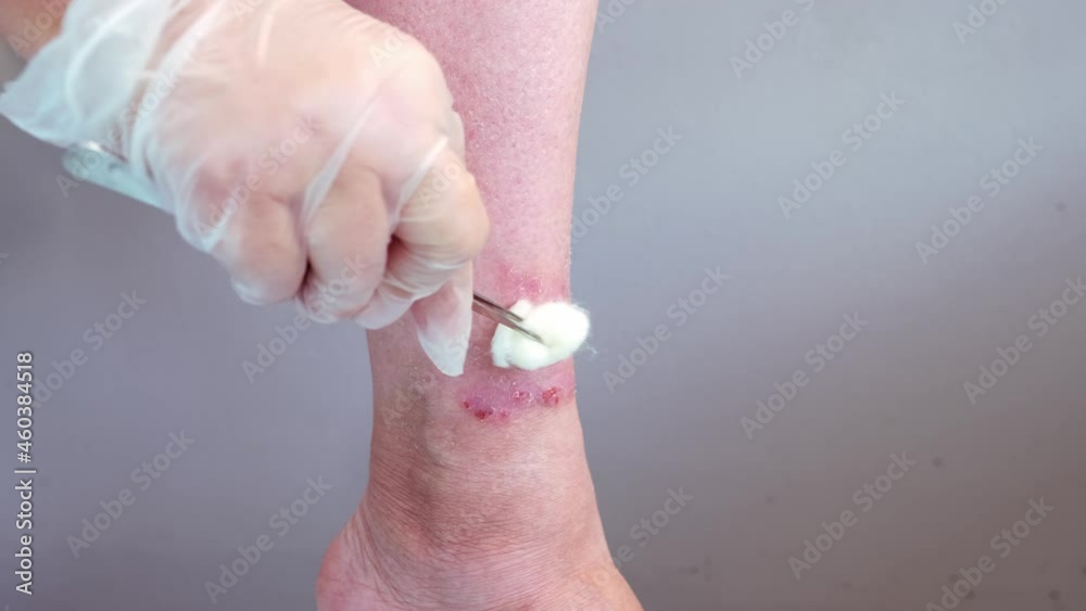 female doctor assistant examines and treats leg woman with scratches ...