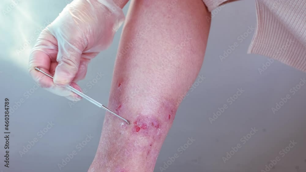 female doctor assistant examines and treats leg woman with scratches ...