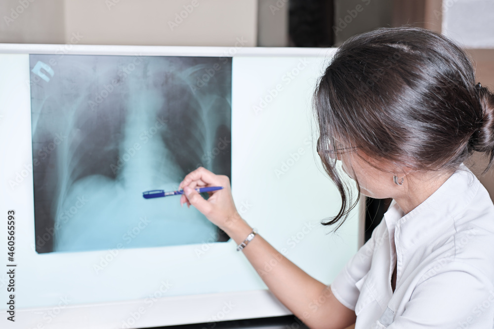 doctor checking chest x-ray image of chest. young brunette woman ...