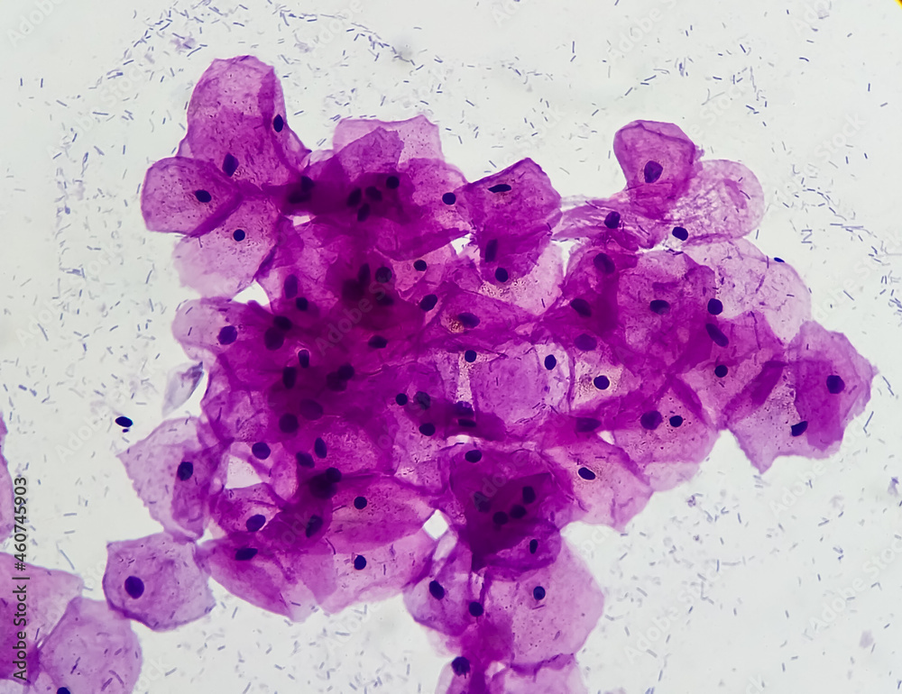 Microscopic view of normal human cervix cells. Squamous epithelial ...