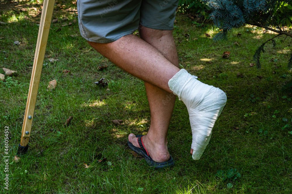 Young man in white plaster cast with broken leg and crutches walks on ...