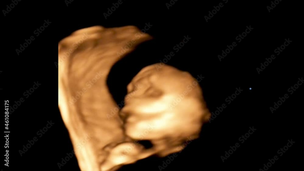 Motion of 4D Ultrasound Echography of baby un mother's womb. Life ...