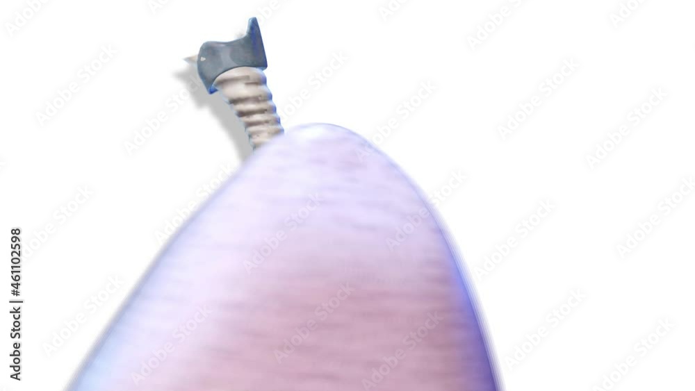 Lungs, internal organs 3D render, anatomy of the human body, white ...