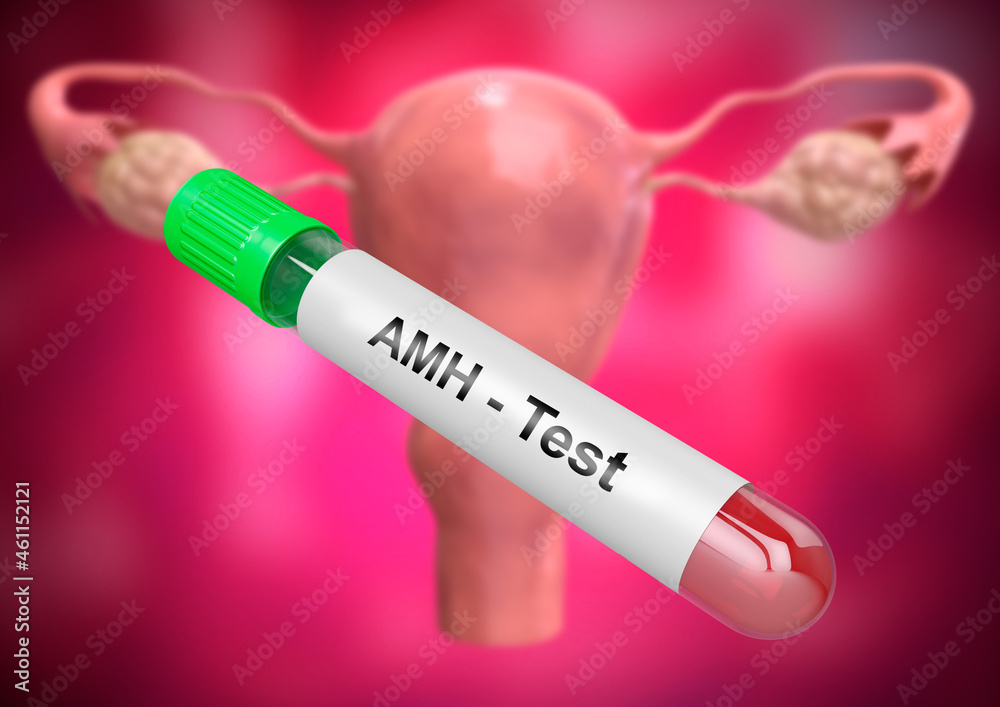 Blood sample tube for anti-Müllerian hormone or AMH test, evaluate of ...