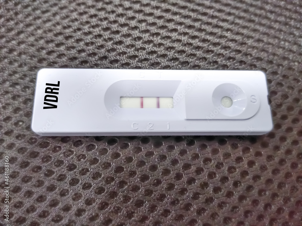 Rapid test cassette for Syphilis test(VDRL) ,The result showed Positive ...