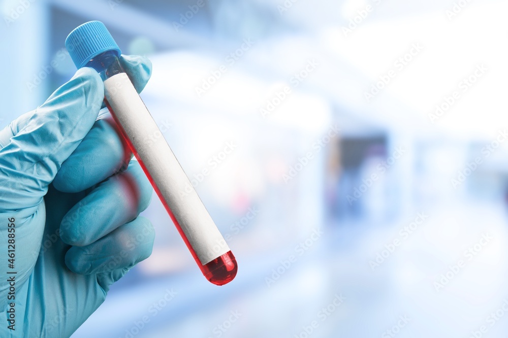 Genetic tests. Laboratory test tube the study of human genetic ...