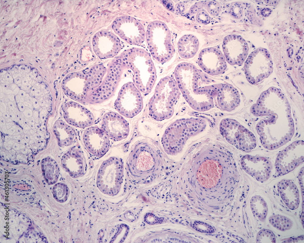 Differences between sebaceous and apocrine sweat glands Stock Photo ...