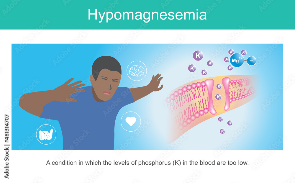 HYPOMAGNESEMIA. Illustration for showing symptoms a man condition in ...