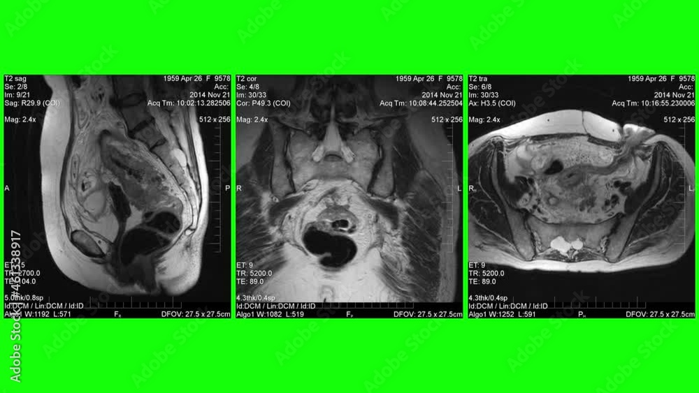 MRI , Magnetic resonance images of human body parts, green background ...