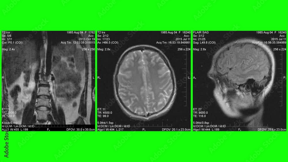 MRI , Magnetic resonance images of human body parts, green background ...