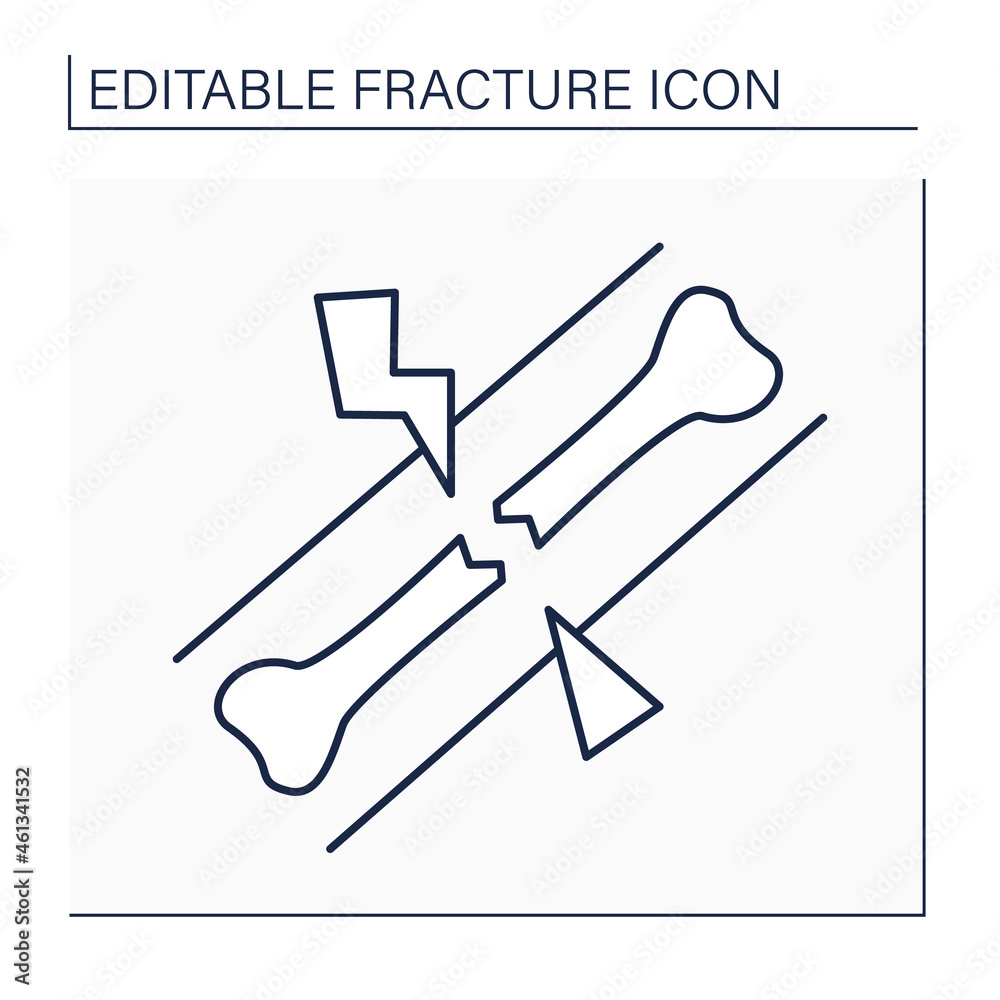 Avulsion fracture line icon.Bone injury near tendon or ligament ...