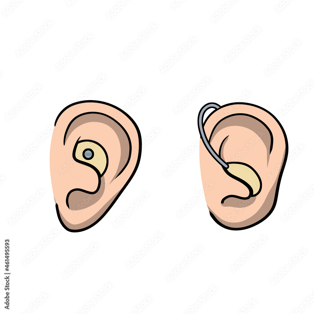 Hearing aid. Audiphone in ear. Set of Cartoon illustration. Hearing ...