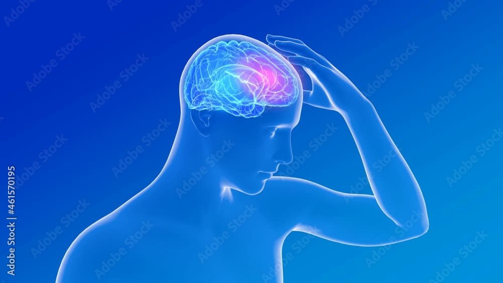 Anatomical 3d animation of human figure showing headache. Epilepsy ...