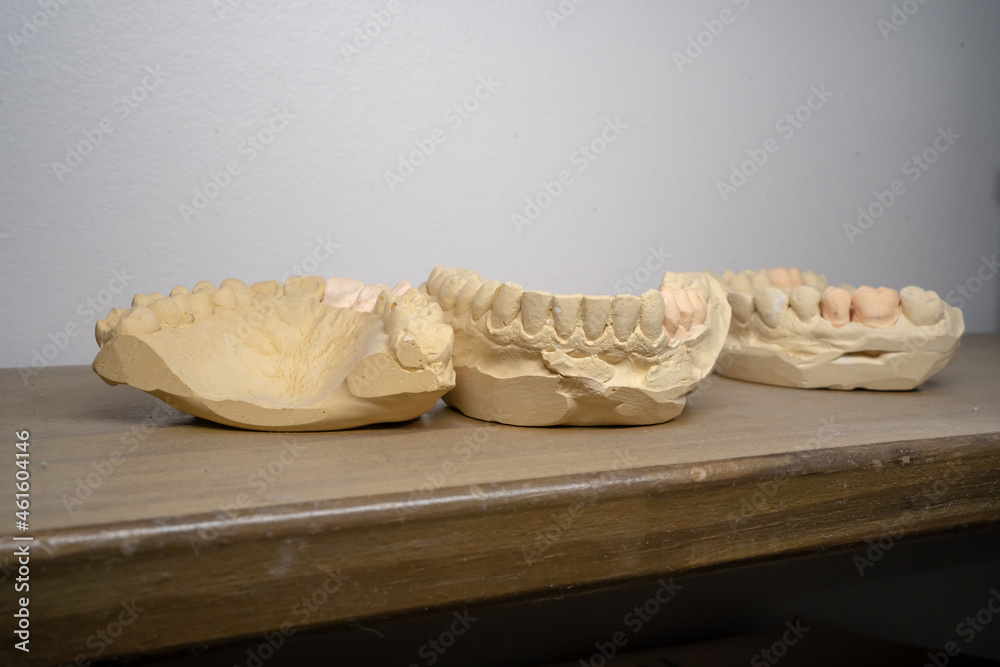 plaster teeth molds. used in making dental prostheses. for dental ...