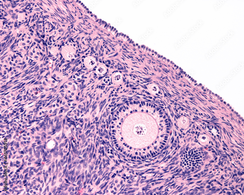 Ovarian cortex. Follicles Stock Photo | Adobe Stock