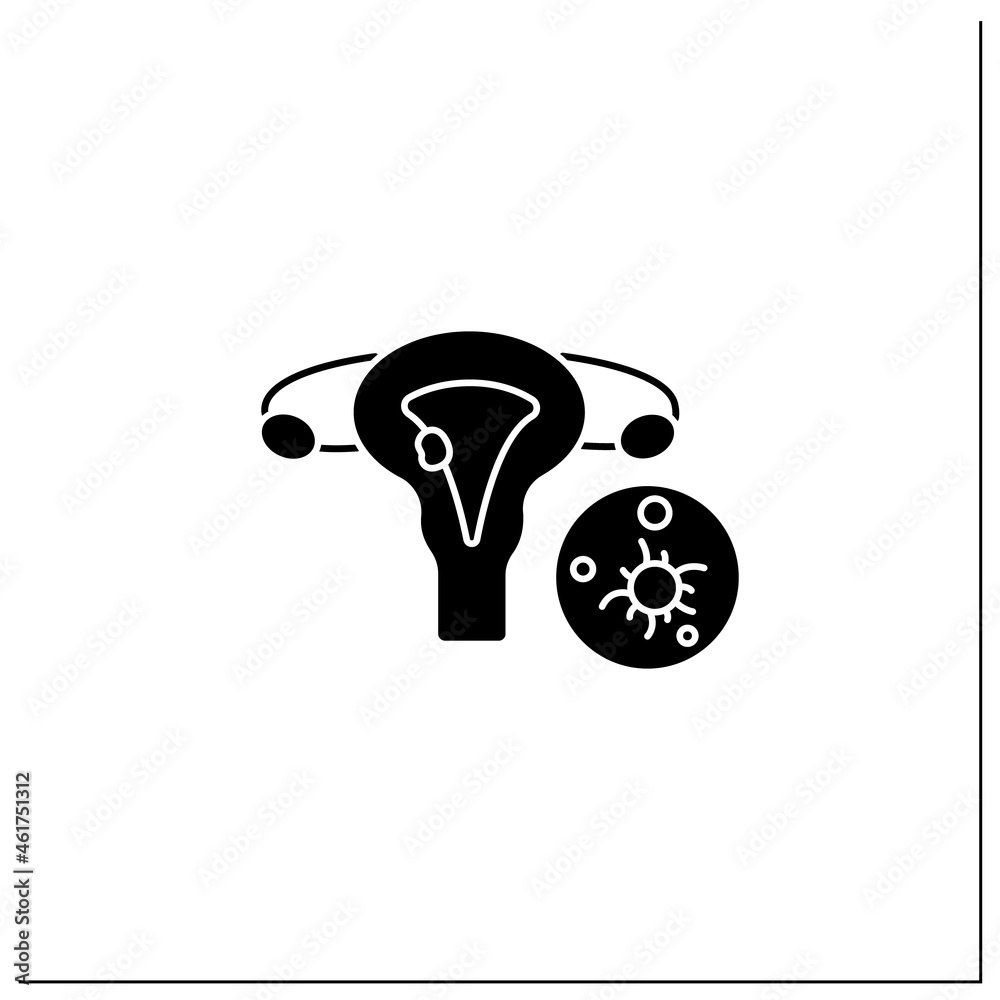 Uterine cancer glyph icon. Reproductive system disease.Malignant tumors ...