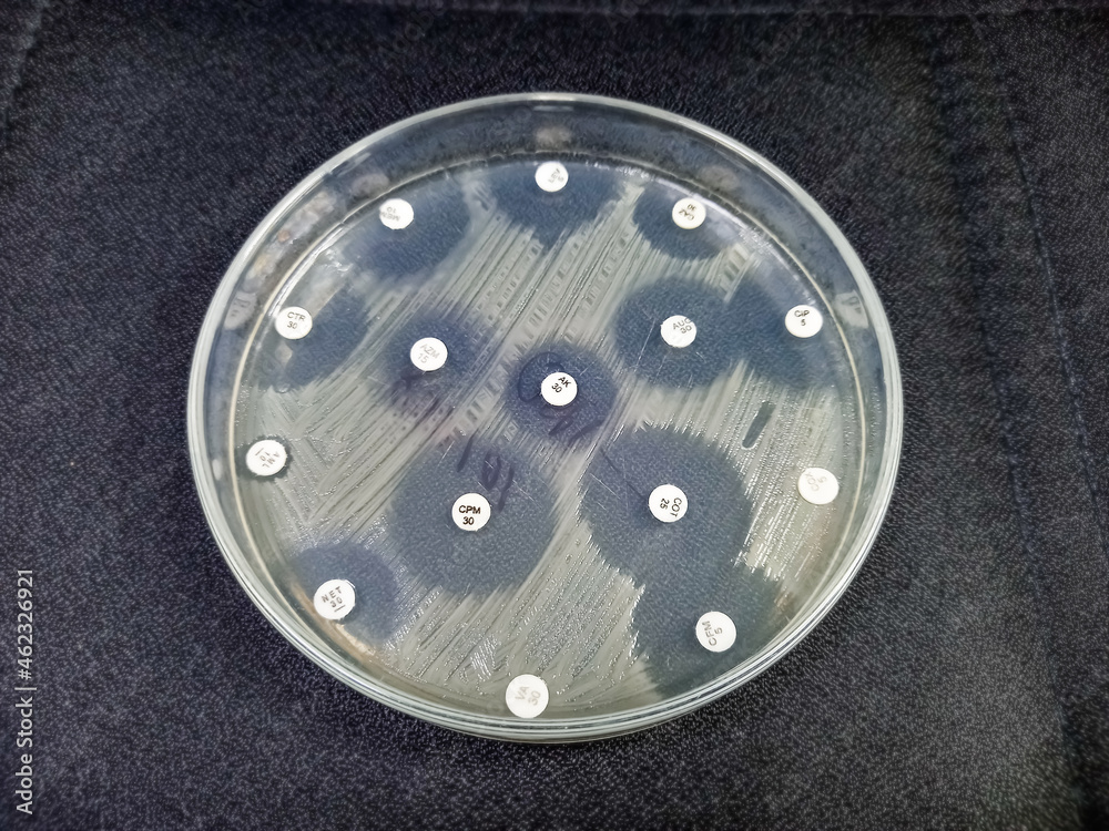 Antimicrobial susceptibility testing in culture plate. Drug sensitivity ...