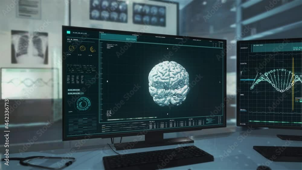 Medical Oncology Research Of Brain In Latest Computer Software ...