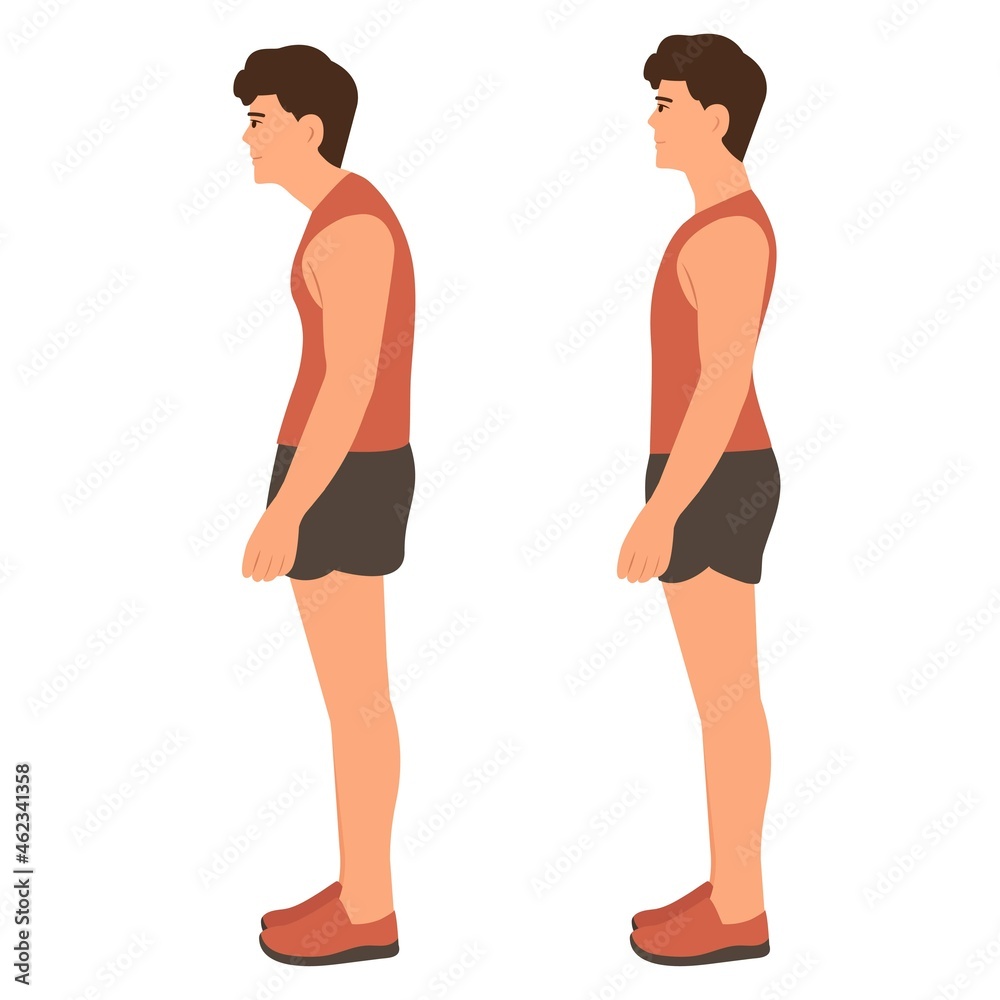 Correct and incorrect standing posture.Cervical spinal curvature. Hump ...