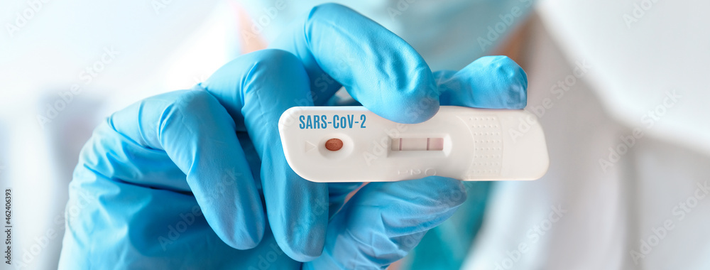 Foto de Doctor shows rapid laboratory COVID-19 test for detection of ... Foto de Doctor shows rapid laboratory COVID-19 test for detection of ...