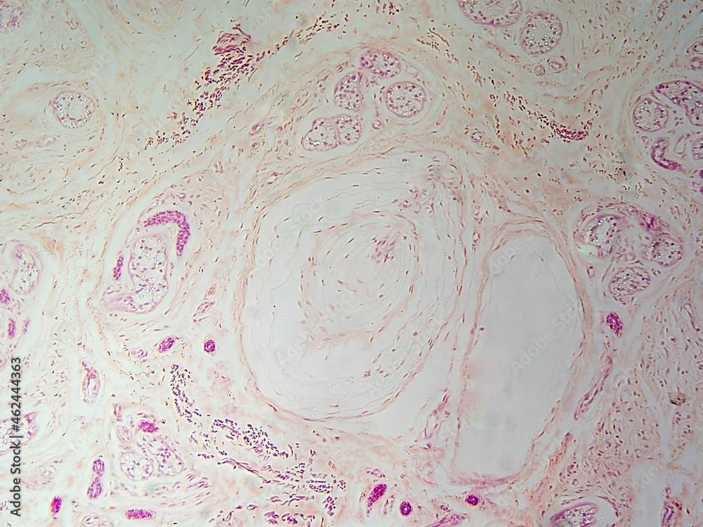 Microscope histology image of Meissner's corpuscle of the dermis (100x ...