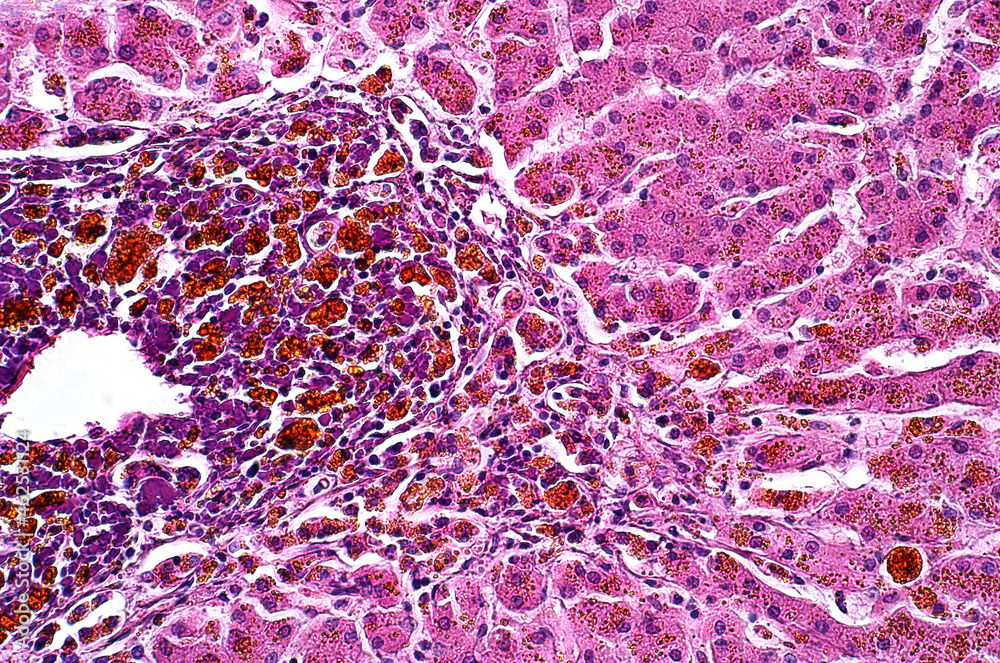 Light microscope Pigmentary of liver pathology. Stock Photo | Adobe Stock