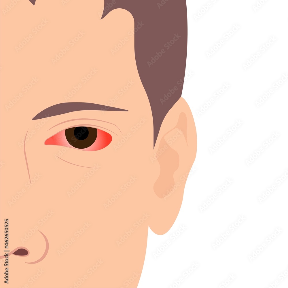 Eye floaters fluid vision retina myopia trauma surgery loss of light ...